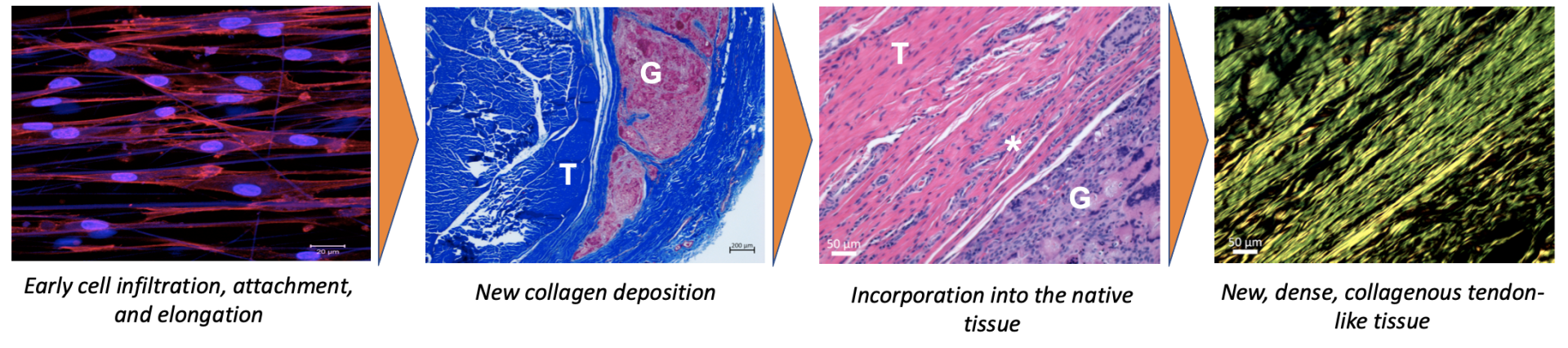 Cell Infiltration - Embody