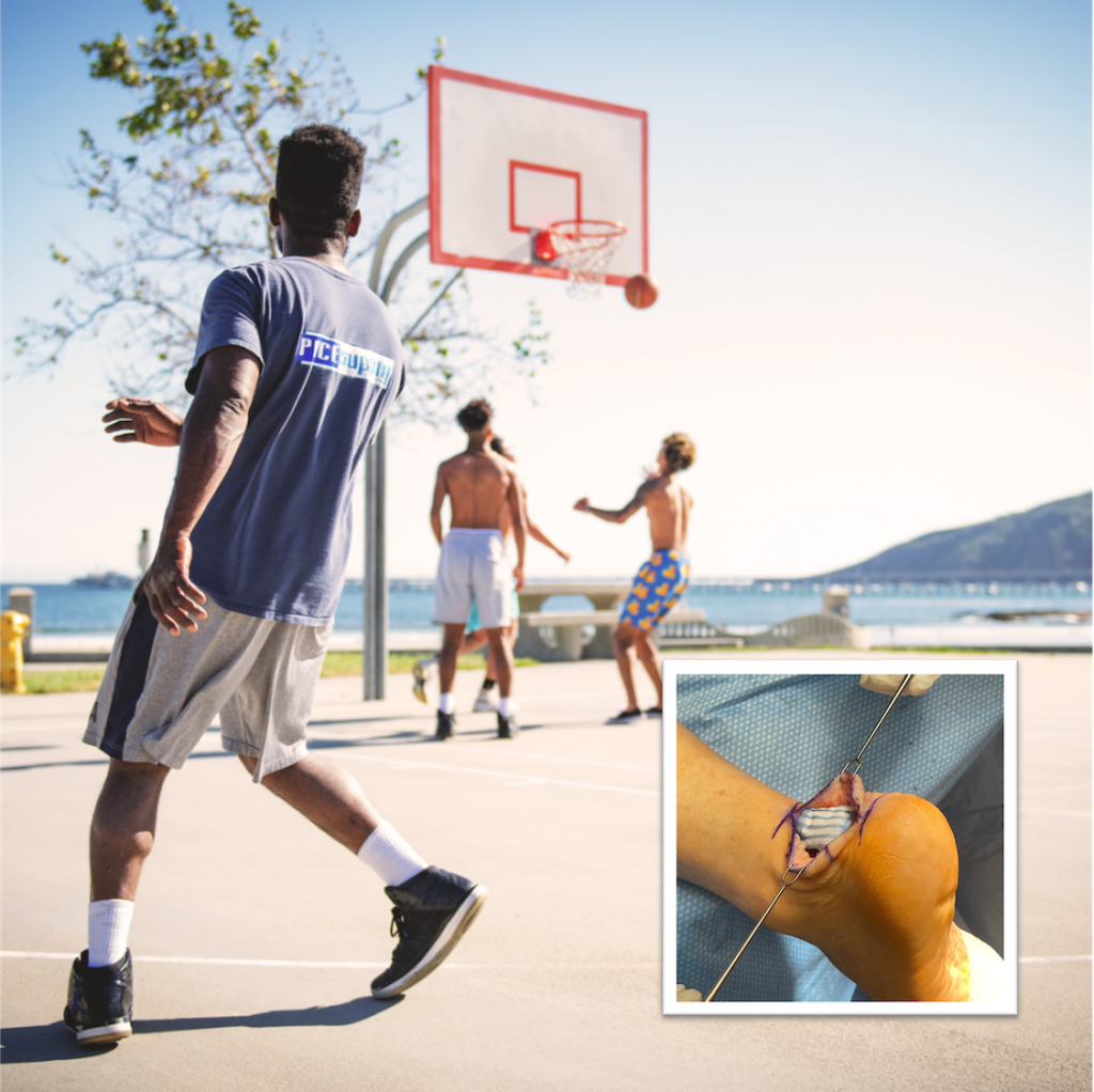 Foot & Ankle Slider 2022 - Embody